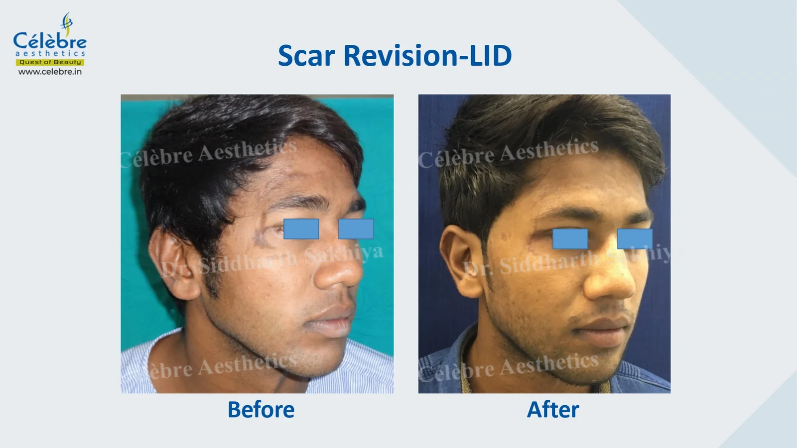 Surat Cosmetic Excellence | Your Gateway to Beauty in 2024